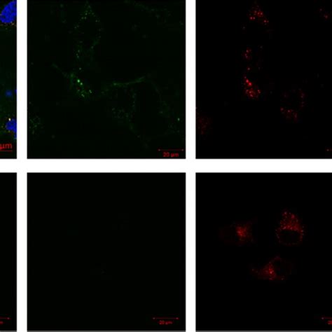 Live Cell Imaging To Assess Internalization And Lysosomal Routing Of Download Scientific