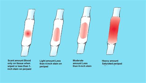 Plan B Spotting Vs Implantation Bleeding Pregnancy Informations