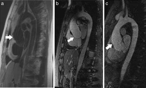 Comparison Of Anatomical Cardiovascular Mri Methods In A 12 Year Old Download Scientific
