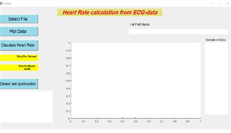 Github Daisy Blossom Heart Rate Calculation Using Ecg Data This Code