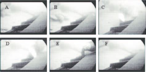 —photographic Sequence Of A Loggerhead Sea Turtle Carcass Encountering
