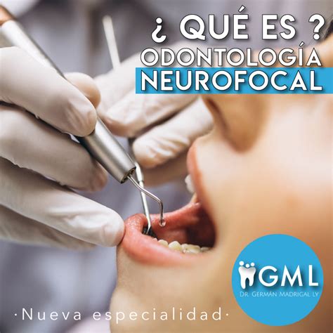 Gml Dental 😀¿ Qué Es La Odontología Neurofocal Nueva