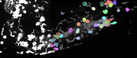 Cellpose For Different Cellular Phenotypes Image Analysis Imagesc Forum