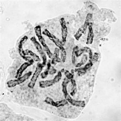 Photomicrograph Showing A Root Tip Chromosome Squash From Trillium Download Scientific Diagram