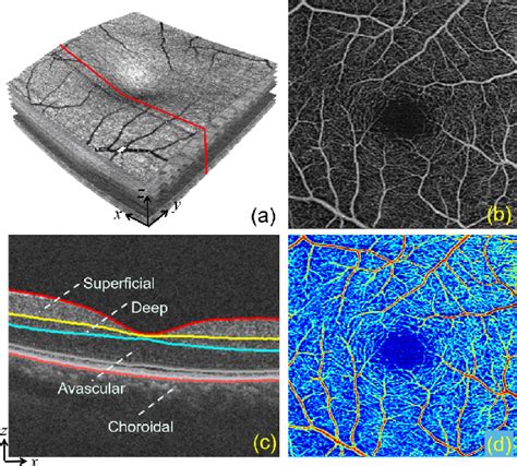 Figure 1 From 3d Vessel Reconstruction In Oct Angiography Via Depth Map Estimation Semantic