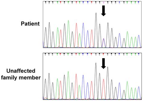 Validation Of Mutation By Sanger Sequencing Download Scientific Diagram