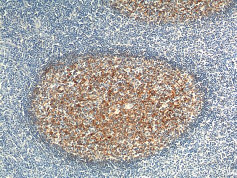 Cd9 Antibody 60232 1 Ig Proteintech