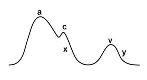 Hemodynamics Flashcards Quizlet