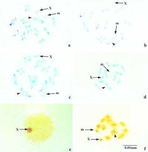 Spermatogonial And Primary Spermatocyte Chromosomes Of Gynacanth