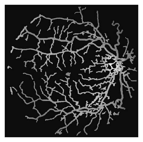 An Example Of 3 Extraction Results The First Row Shows 3 Input Retinal Download Scientific