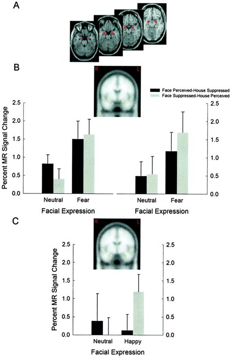 Amygdala Responses to Fearful and Happy Facial Expressions under Conditions of Binocular ...