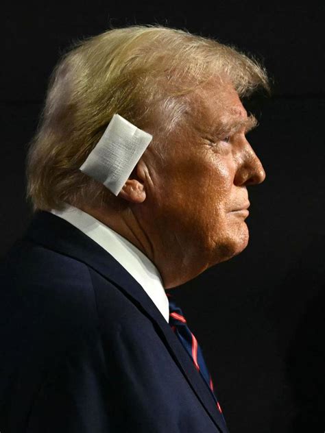 Martina Navratilova Fuels Donald Trump Ear Bandage Conspiracy Theory