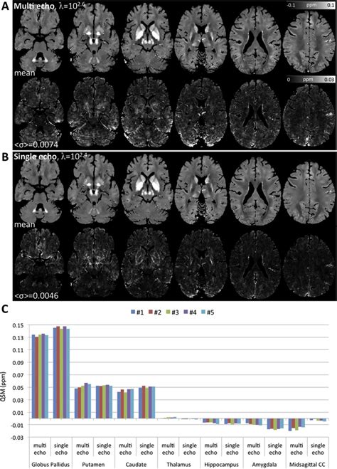 A 3t Multi Echo And B 3t Single Echo Msdi Reproducibility Test