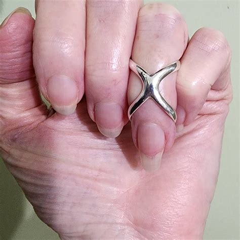 Arthritis Finger Splint Brace Ring For All Types Of Deviation Butterfly Etsy