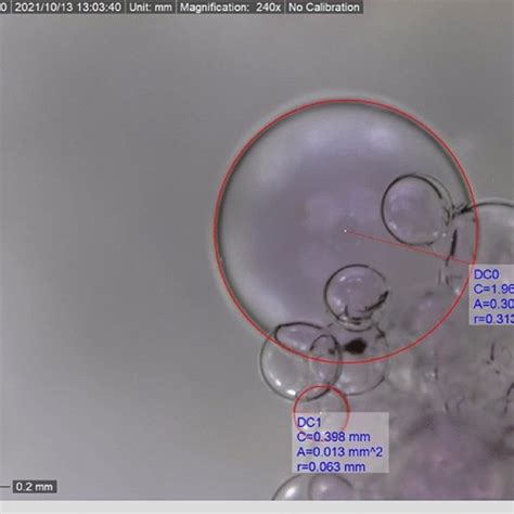 Agar Spray Under Light Microscope With Magnification ×250 With