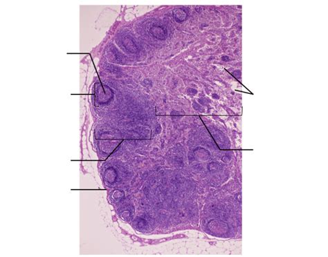 Photomicrograph Of Lymph Node Quiz