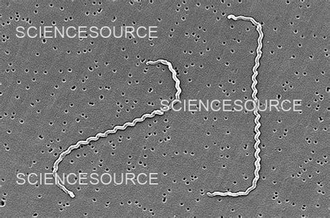 Leptospira Interrogans Bacteria Scann Stock Image Science Source Images