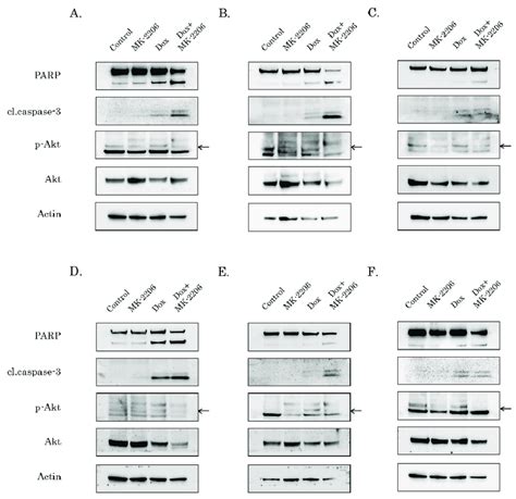 Akt Inhibition Potentiates Pro Apoptotic Activity Of Dox In Sts And