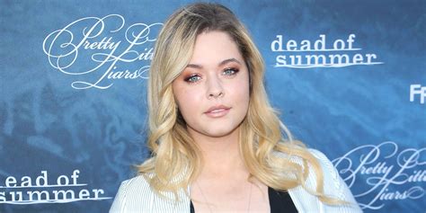 Rhinoplastie De Sasha Pieterse