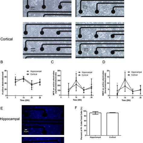 Developmental Profile Of Network Activity In Hippocampal And Cortical