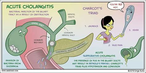 Acute Cholangitis And Acute Suppurative Cholangitis Triad Med Surg Nursing Medical