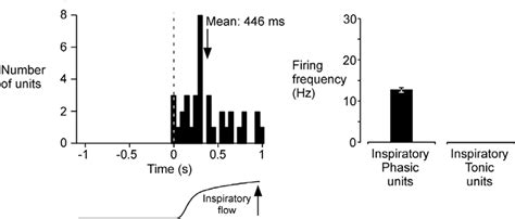 2 Histogram Of The Time Of Onset Of Inspiratory Discharge And The Peak