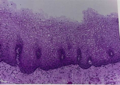 Bio 202 Exam 3 Histology Flashcards Quizlet