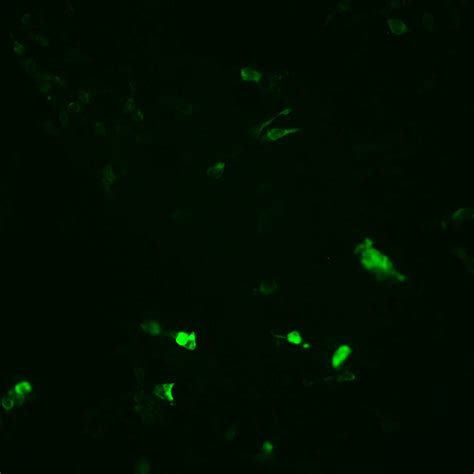 Human Pepsinogen Cpgc 基因 Hg12072 义翘神州