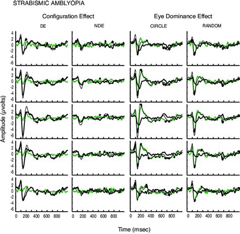 Figure A3 Eye And Configuration Effects For Patients With Strabismic