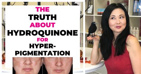 Hydroquinone For Hyperpigmentation