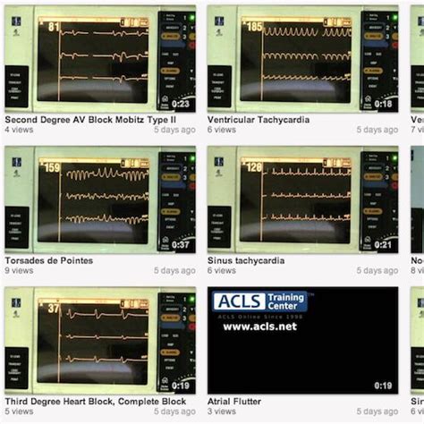 ACLS Quizzes Acls Advanced Cardiac Life Support Acls Algorithm