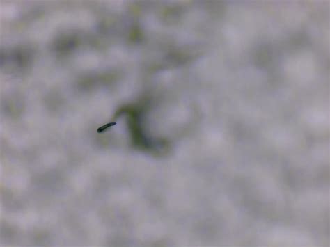 I Have Caught The Star Larvae Both Under My Clothes And Outside Such