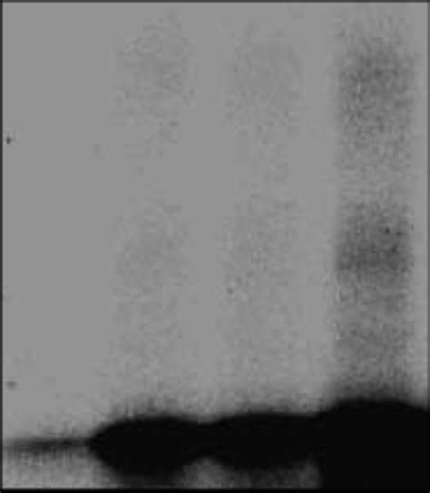 Cripto 1 Inhibits Tgf H 1 Mediated Senescence In V Ras Ha Download Scientific Diagram