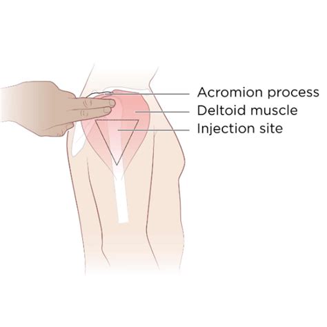 Intramuscular Injection Needle Free Injection Comfort In Certified Device