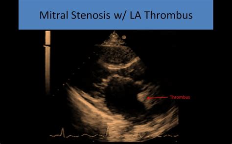 Ultrasound Registry Review
