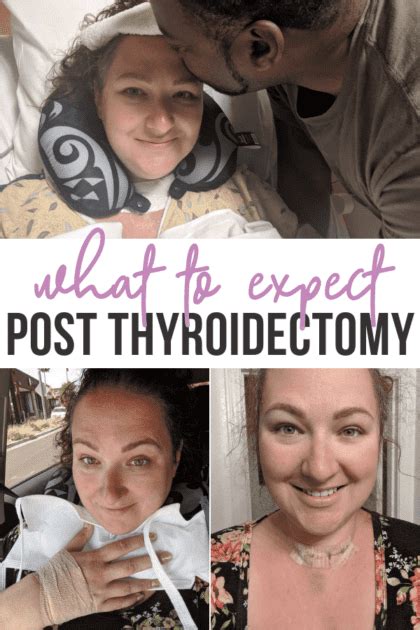 Thyroidectomy What To Expect Sadie Smiley