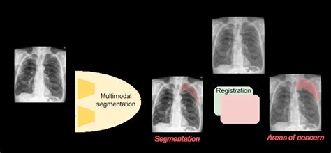Vision Language Multimodal Models Could Help Physicians Analyse Download Scientific Diagram