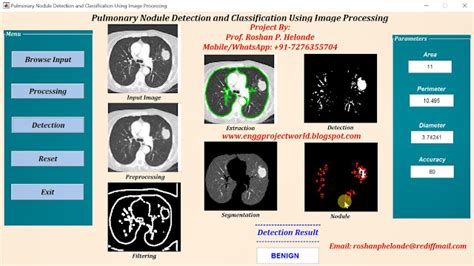 Lung Nodule Detection Using Image Processing Matlab Project With Source Code IEEE Based Projects