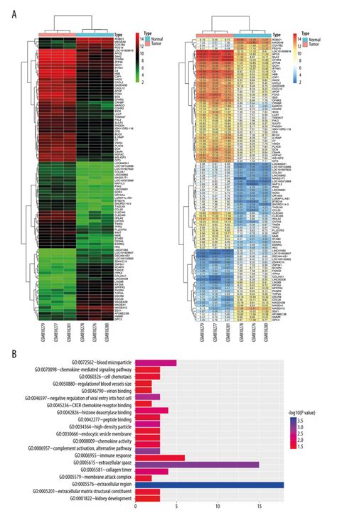H Long Terminal Repeat Associating 2 Hhla2 Is A Biomarker Of Advanced Stage Hepatocellular