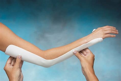 Conxport Long Arm Splint At Best Price In Ambala Cantt Contemporary