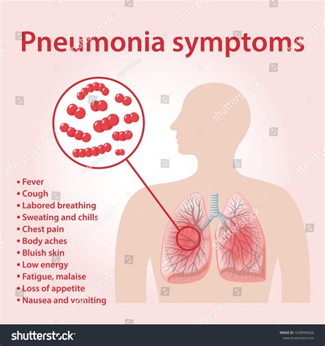 Streptococcus Pneumoniae In Lungs