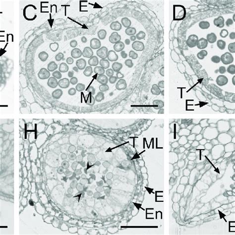 Transmission Electron Microscopy Observation Of Microspore Development Download Scientific
