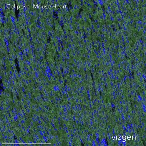 Customize Cell Segmentation With Cellpose2 Plugin Vizgen Posted On The Topic Linkedin