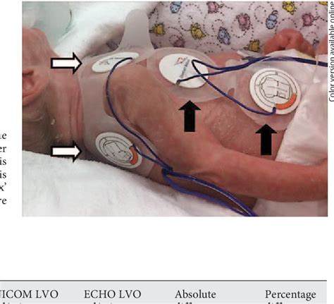 Figure 1 From Non Invasive Cardiac Output Monitoring In Neonates Using