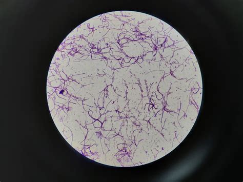 Actinomyces Introduction Morphology Pathogenicity Lab
