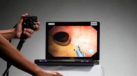 You Might Not Need A Colonoscopy To Be Screened For Colon Cancer