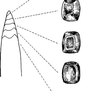 Schematic Representation Based On MCL Specimens Of Wear In The Download Scientific Diagram