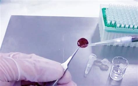 Arrayit Whole Blood Collection Cards