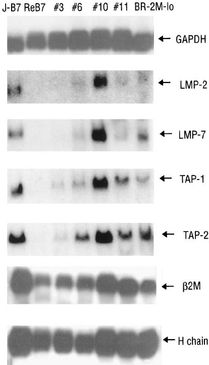 Expression Of Multiple Antigen Presentation Genes In The Recurrent