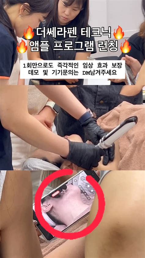 메디코스니컬 브랜드 더쎄라 공식 계정 🟠20250623월 런칭🟠 1회만으로도 즉각적인 임상사진 다수 보유 No스테로이드 No통증 No붓기 No다운타임
